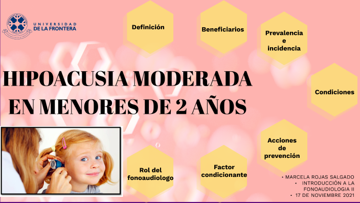 HIPOACUSIA MODERADA by Marcela Rojas Salgado on Prezi