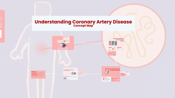 Concept Map: Coronary Artery Disease by Vanessa Hernandez on Prezi