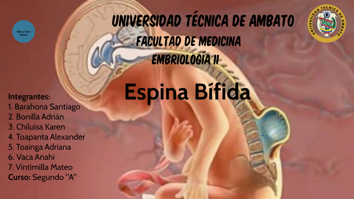 Espina Bifida abierta y oculta by Mateo Vintimilla on Prezi