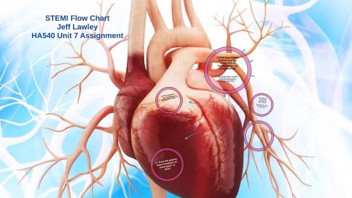 STEMI Flow Chart Jeff Lawley HA540 Unit 7 Assignment by Jeff Lawley on ...