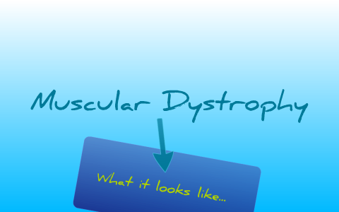 Muscular Dystrophy Visual Aid by Skye Thebo on Prezi