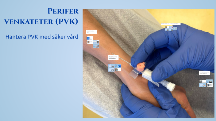 Perifer venkateter (PVK) by Linda Ahlstrom on Prezi