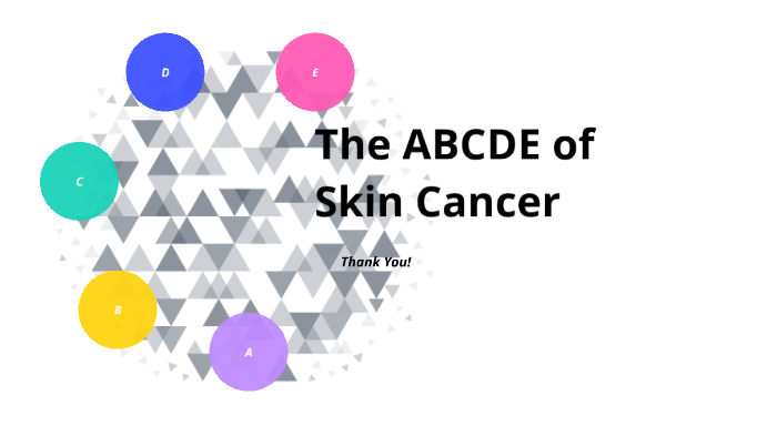 abcde of skin cancer by megan arnold on Prezi