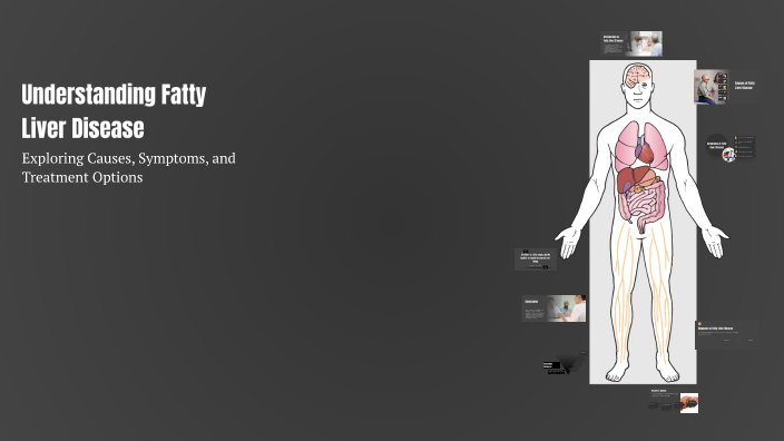 Understanding Fatty Liver Disease by Osama Wael on Prezi