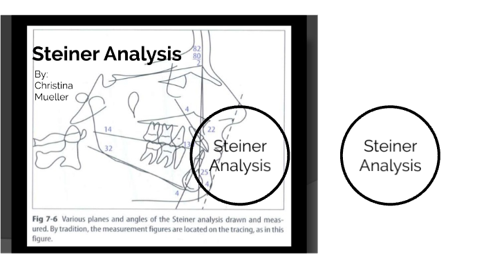 Steiner Ceph Analysis by Christina Mueller on Prezi