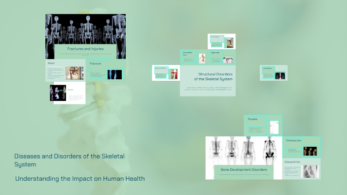 Diseases and Disorders of the Skeletal System by Jayden Garcia on Prezi