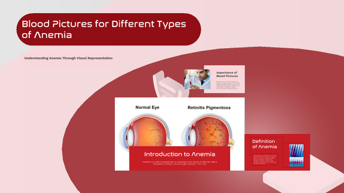 Blood Pictures for Different Types of Anemia by Hgg Kj on Prezi