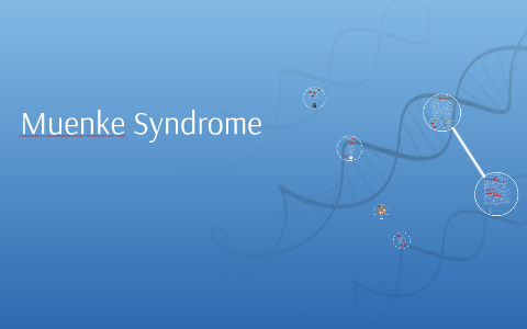Muenke Syndrome by Cian Carrigan on Prezi