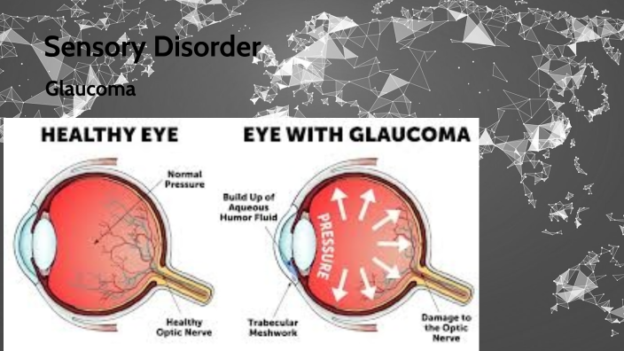 Sensory Disorder by Jonnelle Chavez on Prezi