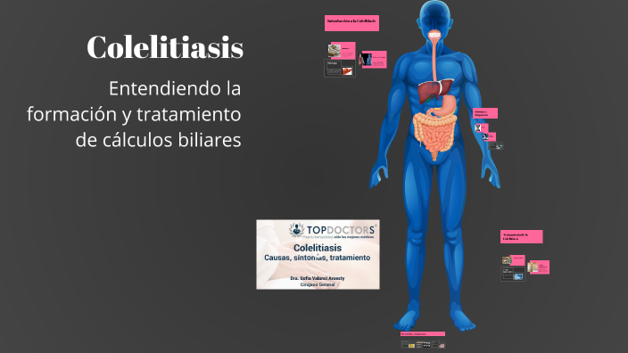 Colelitiasis by kestyel martinez on Prezi