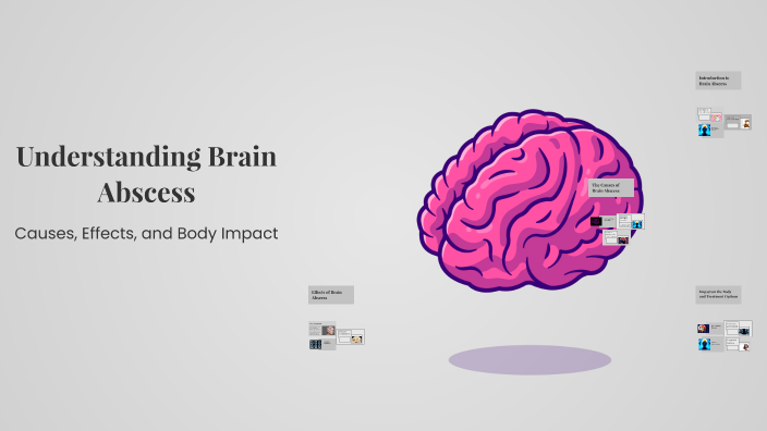 Understanding Brain Abscess by SaNiyah Lewis on Prezi