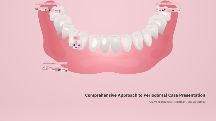 Comprehensive Approach to Periodontal Case Presentation by Karina Radu ...