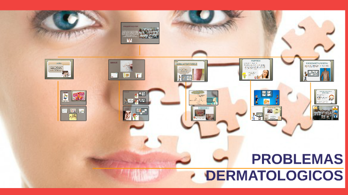 PROBLEMAS DERMATOLOGICOS by jhony restrepo on Prezi
