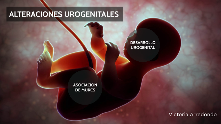 ALTERACIÓN DE MURCS by Victoria Arredondo on Prezi