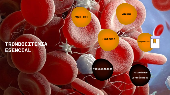 TROMBOCITEMIA ESENCIAL by UGA LAB on Prezi