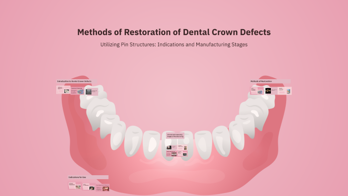 Methods of Restoration of Dental Crown Defects by Yashar Rad on Prezi