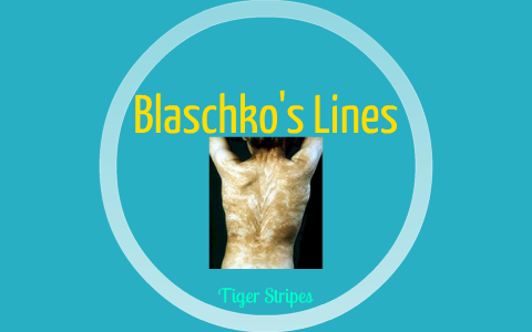 Blaschko's Lines by gia reilly on Prezi
