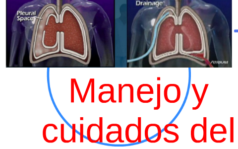 Manejo y cuidados del tubo torácico by KATERIN CUENCA on Prezi