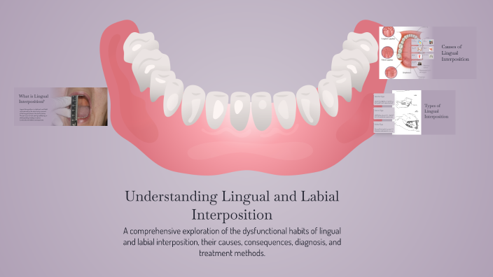 Understanding Lingual and Labial Interposition by Kaouther on Prezi