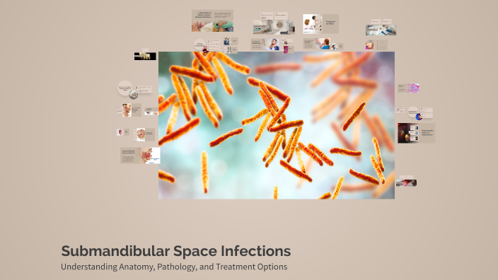 Submandibular Space Infections by Fatma Makki on Prezi