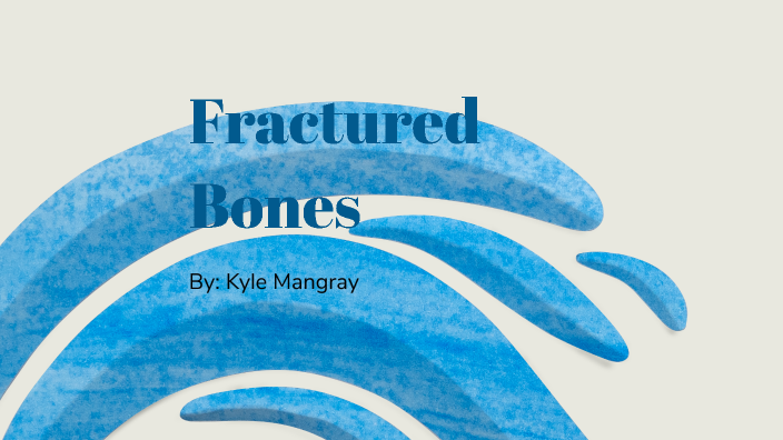 Fracture Types by Kyle Mangray on Prezi