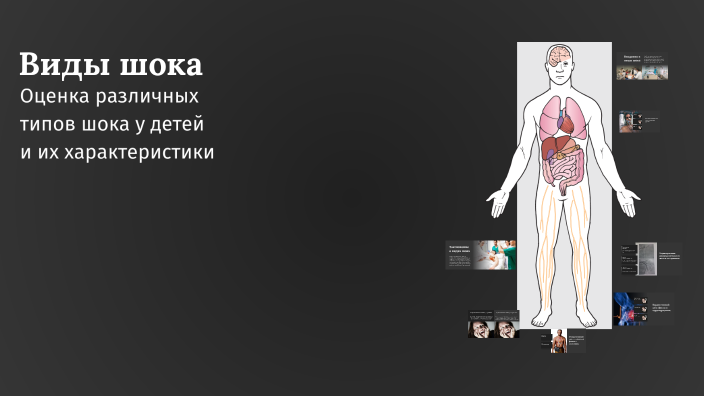 Виды шока by Barchyn Turdalieva on Prezi