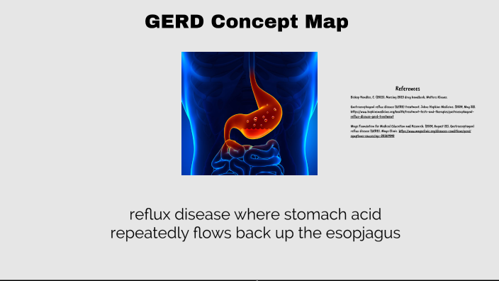 GERD Concept map by Vincent Nguyen on Prezi