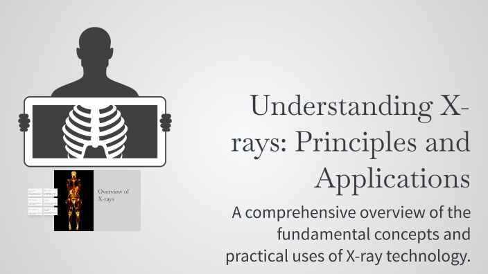 Understanding X-rays: Principles and Applications by محمد عبدالرحمن on ...