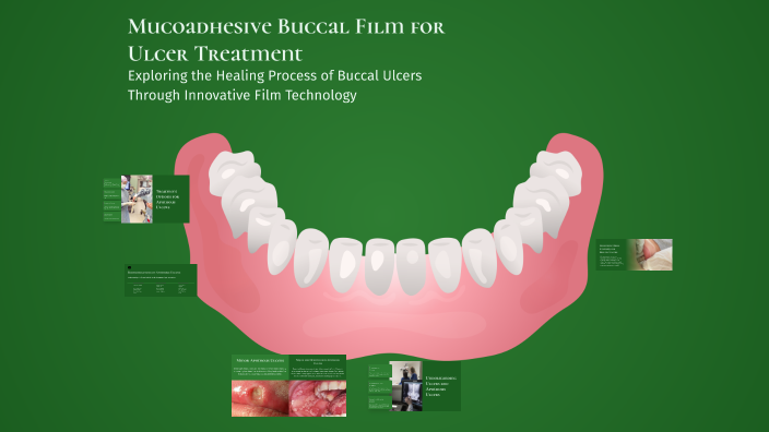 Mucoadhesive Buccal Film for Ulcer Treatment by basma ismail on Prezi