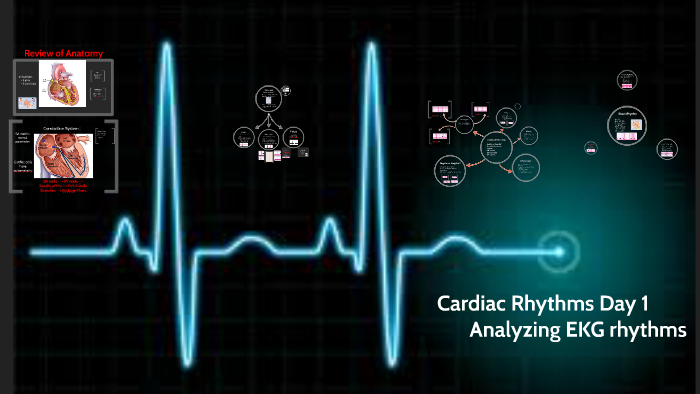 Analyzing EKG Rhythm Strips by Jamie Hartman on Prezi