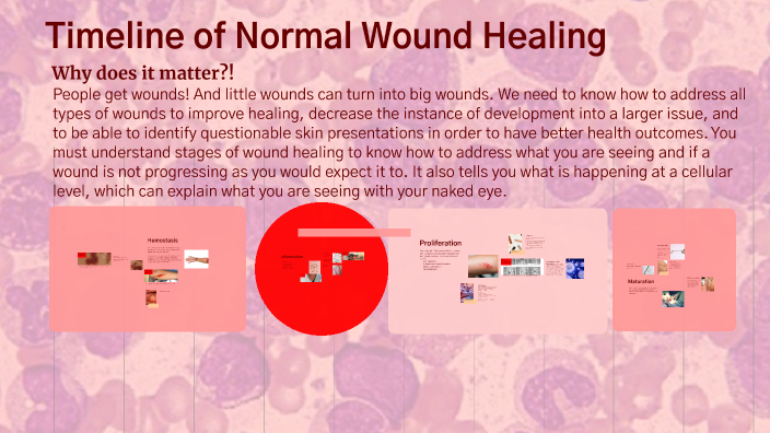 Timeline of Normal Wound Healing by Sophie Rossmiller on Prezi