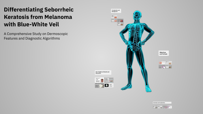 Differentiating Seborrheic Keratosis from Melanoma with Blue-White Veil ...