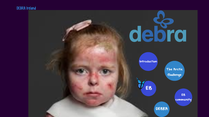 DEBRA Ireland by laura power on Prezi