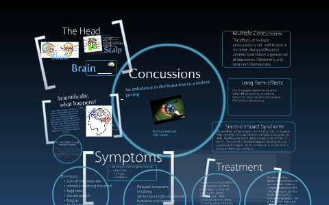 Concussion Presentation by Kyle Frame on Prezi