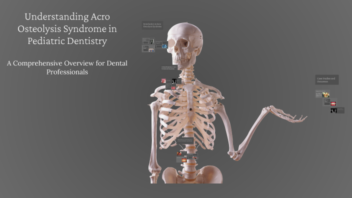 Understanding Acro Osteolysis Syndrome in Pediatric Dentistry by ...