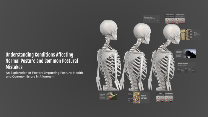Understanding Conditions Affecting Normal Posture and Common Postural ...