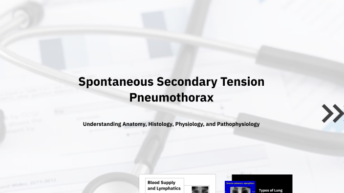 Spontaneous Secondary Tension Pneumothorax by Vaness Viendry on Prezi