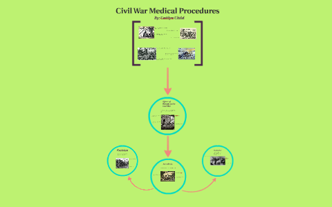 Civil War Medical Procedures by Frederic Child on Prezi