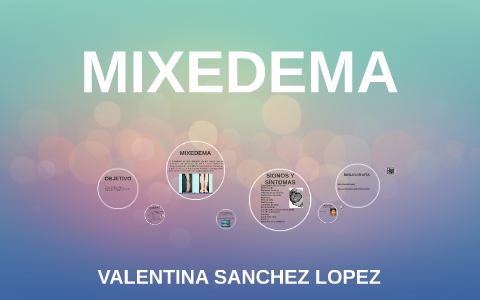 MIXEDEMA by on Prezi