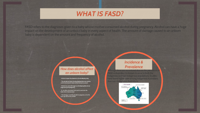 Foetal Alcohol Syndrome by Emily Aldous