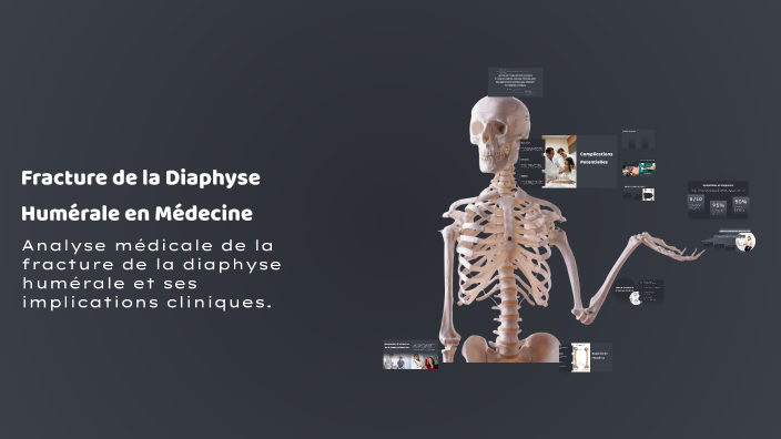 Fracture de la Diaphyse Humérale en Médecine by reda reda on Prezi