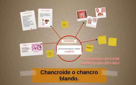 Chancroide o chancro blando. by Angie Grullon on Prezi