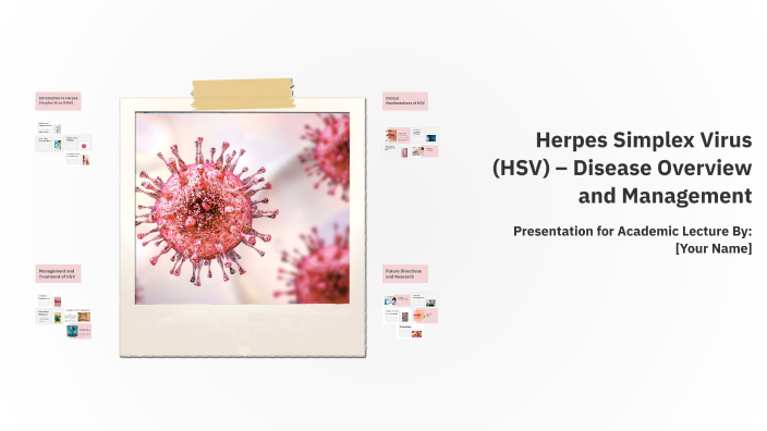 Herpes Simplex Virus (HSV) – Disease Overview and Management by Ahmad ...