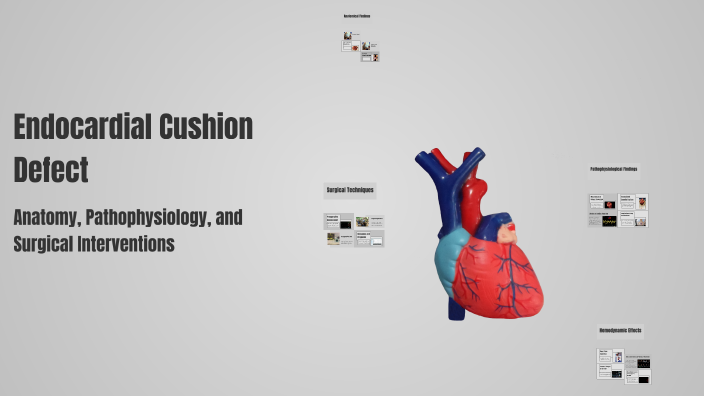 Endocardial Cushion Defect by Anniston Brubaker on Prezi