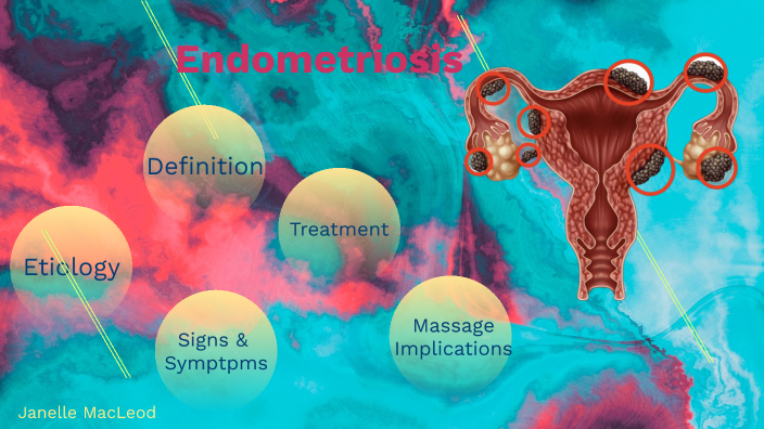 Endometriosis by Janelle MacLeod on Prezi
