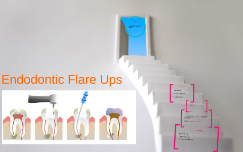 Endodontic Flare Ups by on Prezi