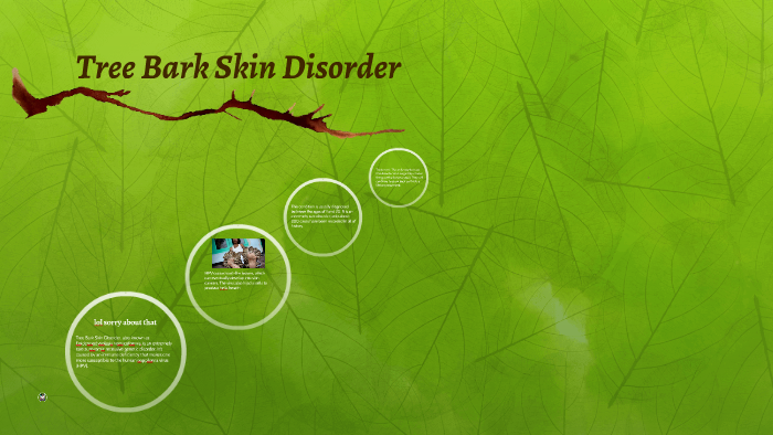 Tree Bark Skin Disorder by Hannah S on Prezi
