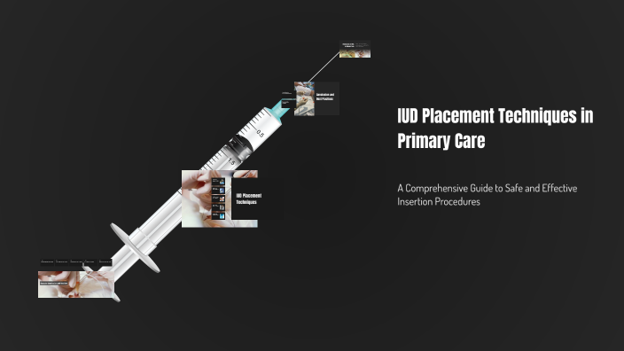 IUD Placement Techniques in Primary Care by Sarah Stowell on Prezi