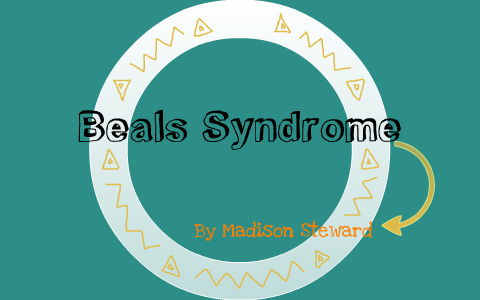 Beals Syndrome by Madison Steward on Prezi