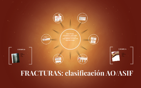 FRACTURAS: clasificación AO/ASIF by yasmin gonzalez on Prezi